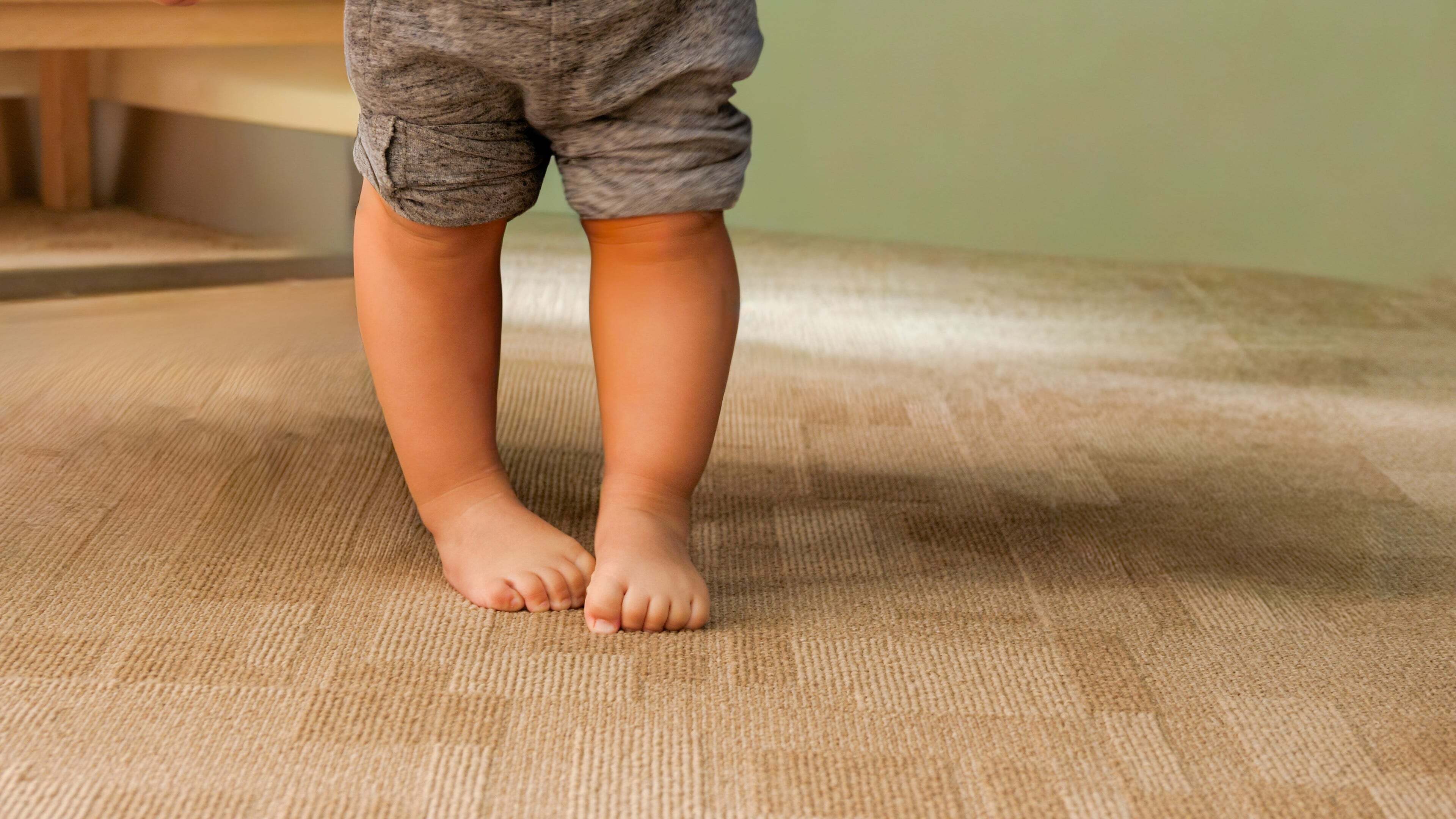 Curly Toe Syndrome | East Coast Podiatry Singapore