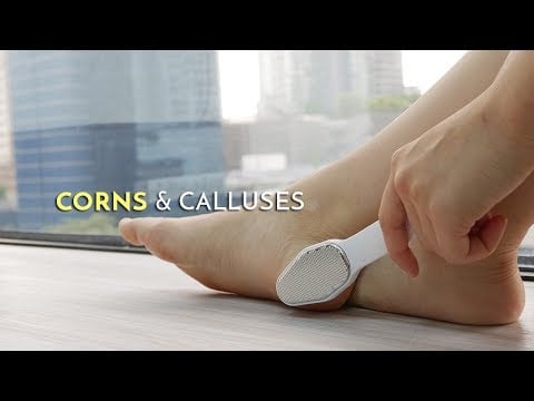 Foot Callus Causes, Symptoms & Removal | East Coast Podiatry