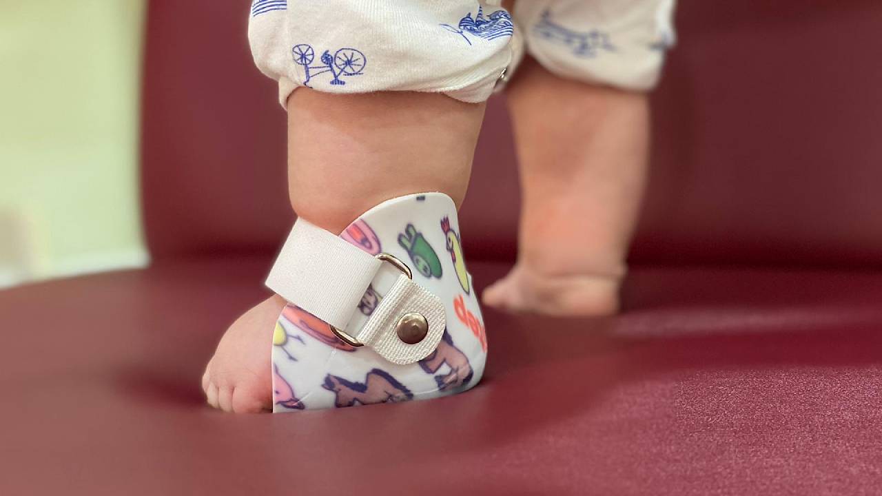 Paediatric AFO | East Coast Podiatry Singapore